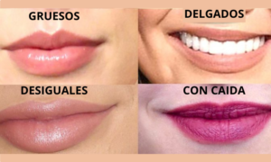 Cuál es la mejor forma de labios - Stetica.es