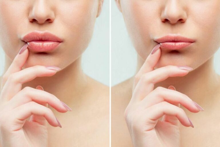 Cuál es la técnica rusa en labios - Stetica.es